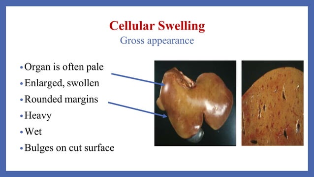 Difference between reversible and irreversible cell injury,Mechanism of ...