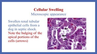 Difference between reversible and irreversible cell injury,Mechanism of ...