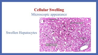 Difference between reversible and irreversible cell injury,Mechanism of ...