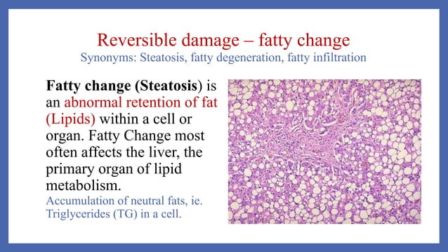 Difference between reversible and irreversible cell injury,Mechanism of ...
