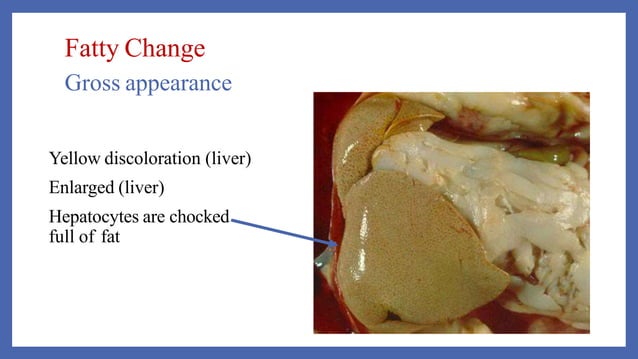 Difference between reversible and irreversible cell injury,Mechanism of ...