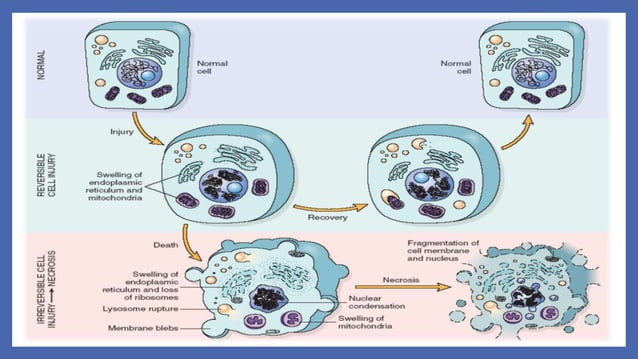 Difference between reversible and irreversible cell injury,Mechanism of ...
