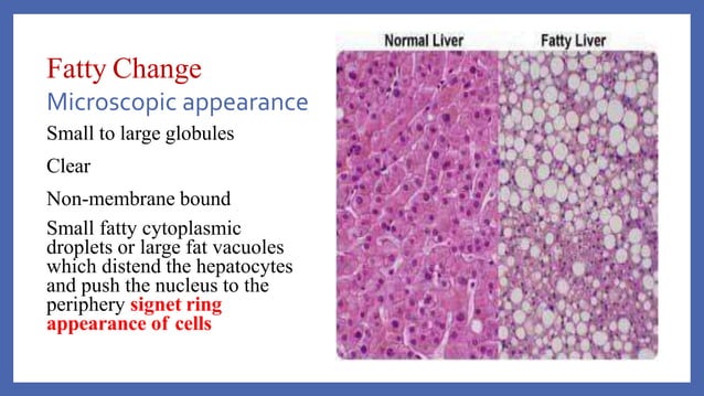 Difference between reversible and irreversible cell injury,Mechanism of ...
