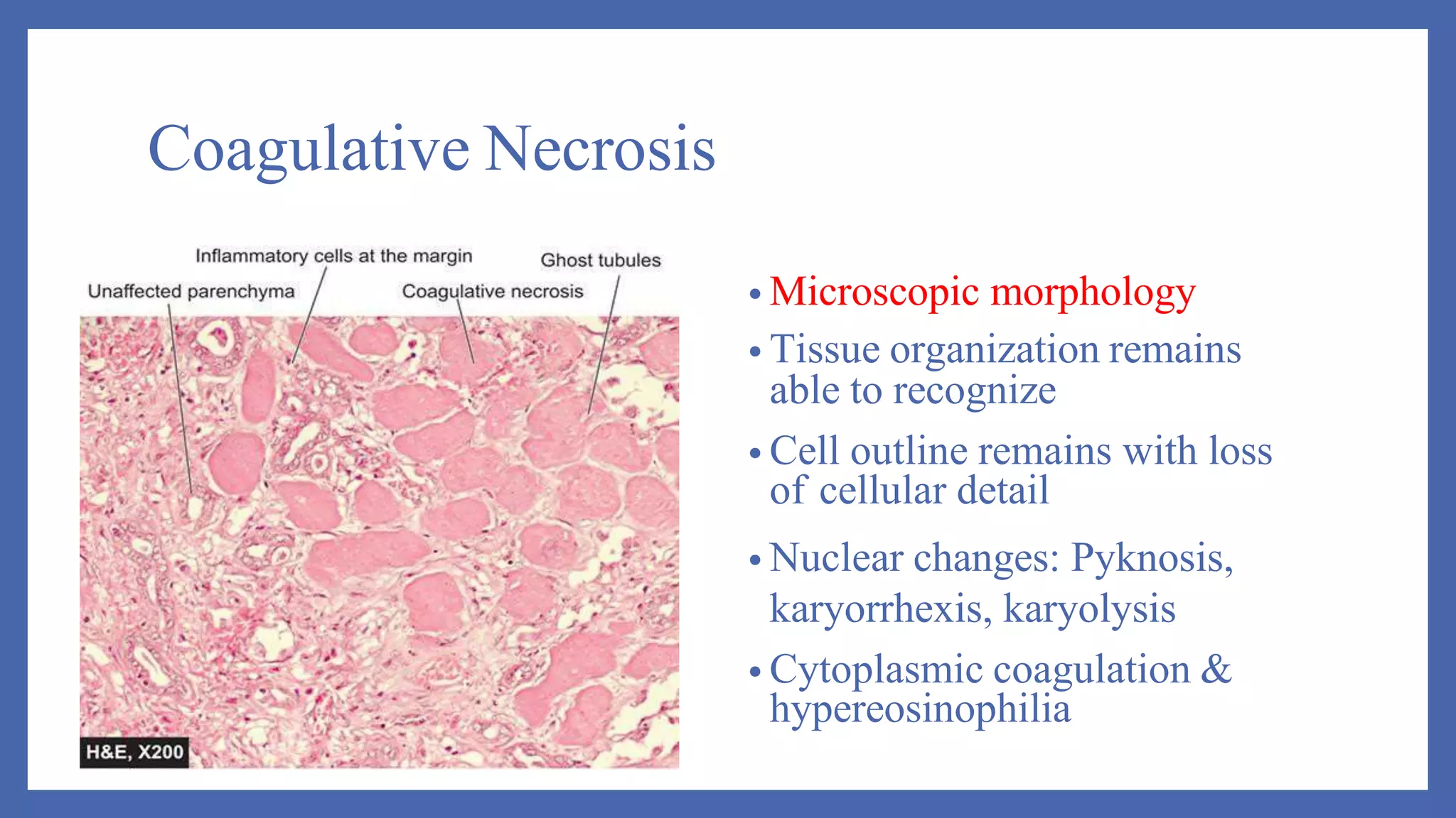 Difference between Apoptosis versus Necrosis and Types of Necrosis.pptx