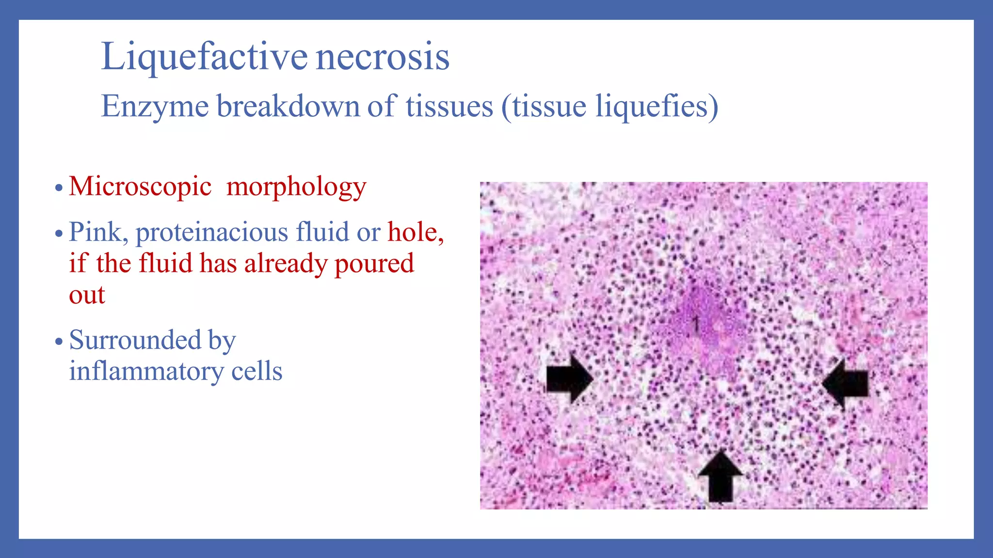 Difference between Apoptosis versus Necrosis and Types of Necrosis.pptx
