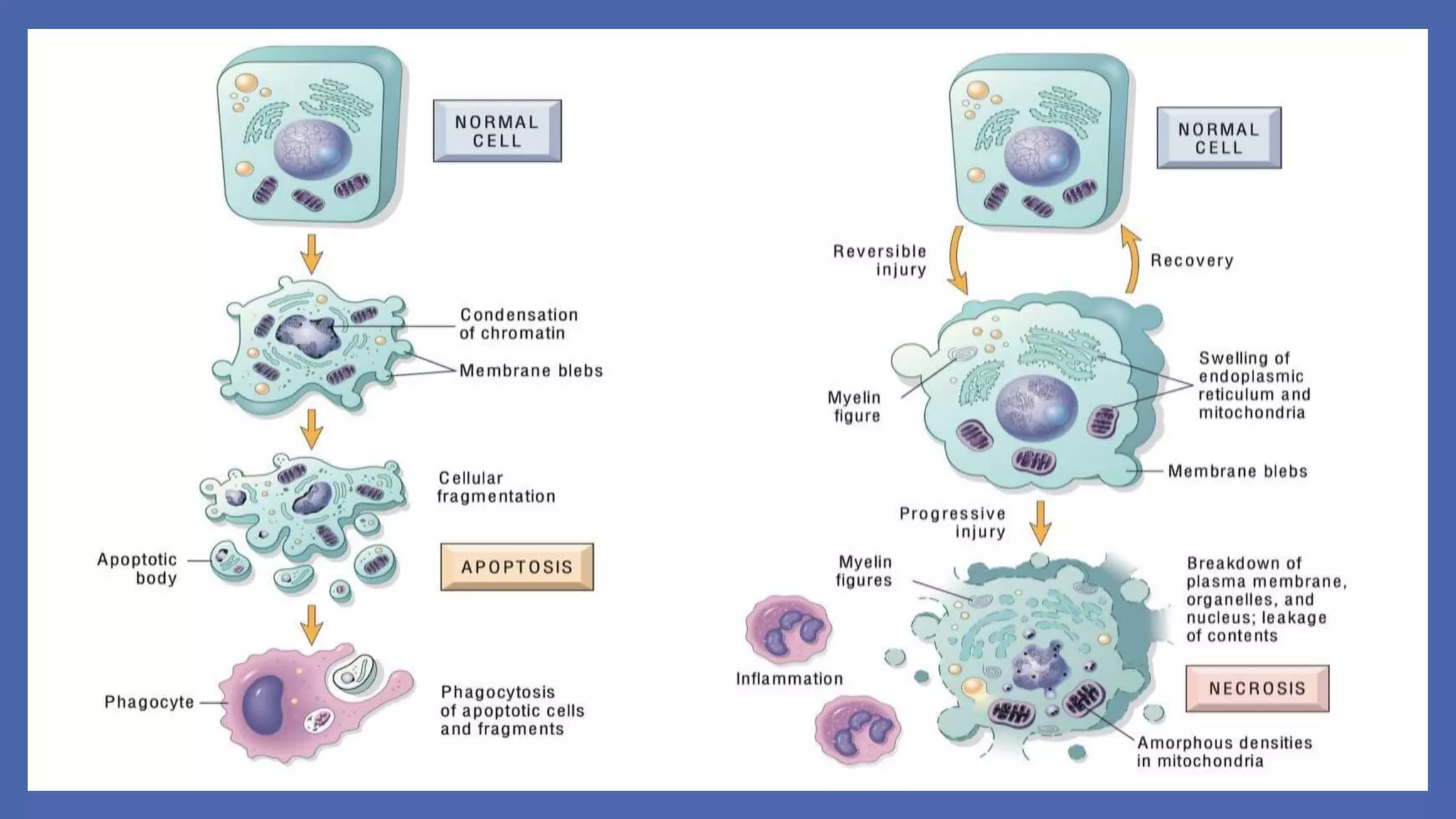 Difference between Apoptosis versus Necrosis and Types of Necrosis.pptx