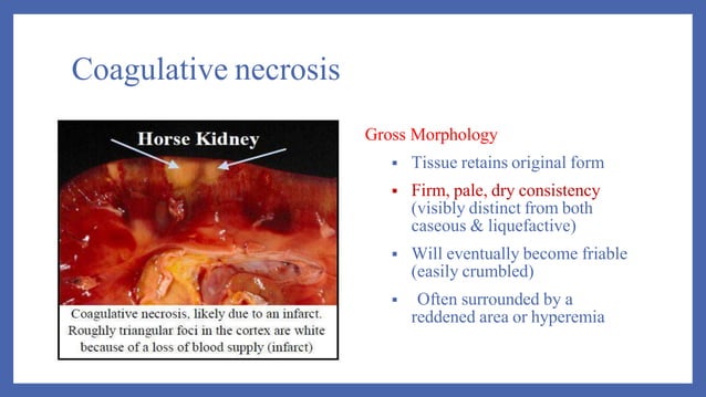 Difference between Apoptosis versus Necrosis and Types of Necrosis.pptx