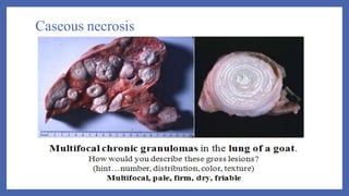 Difference between Apoptosis versus Necrosis and Types of Necrosis.pptx
