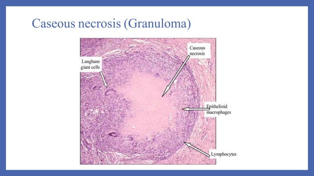 Difference between Apoptosis versus Necrosis and Types of Necrosis.pptx