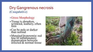 Difference between Apoptosis versus Necrosis and Types of Necrosis.pptx
