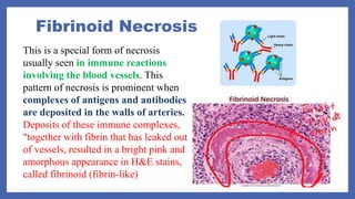 Difference between Apoptosis versus Necrosis and Types of Necrosis.pptx