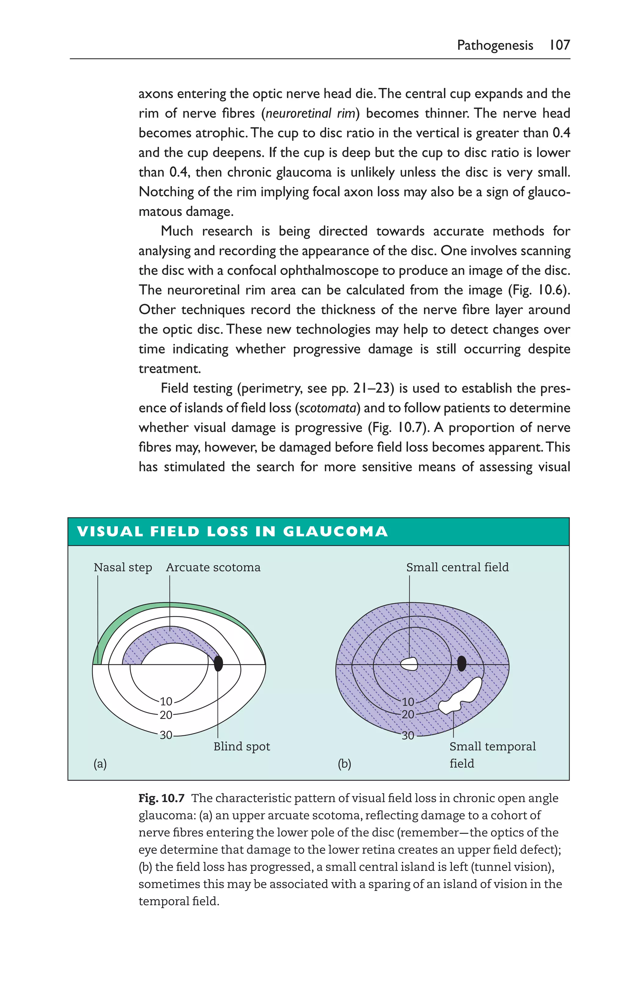 Lecture Notes on Ophthalmology.pdf