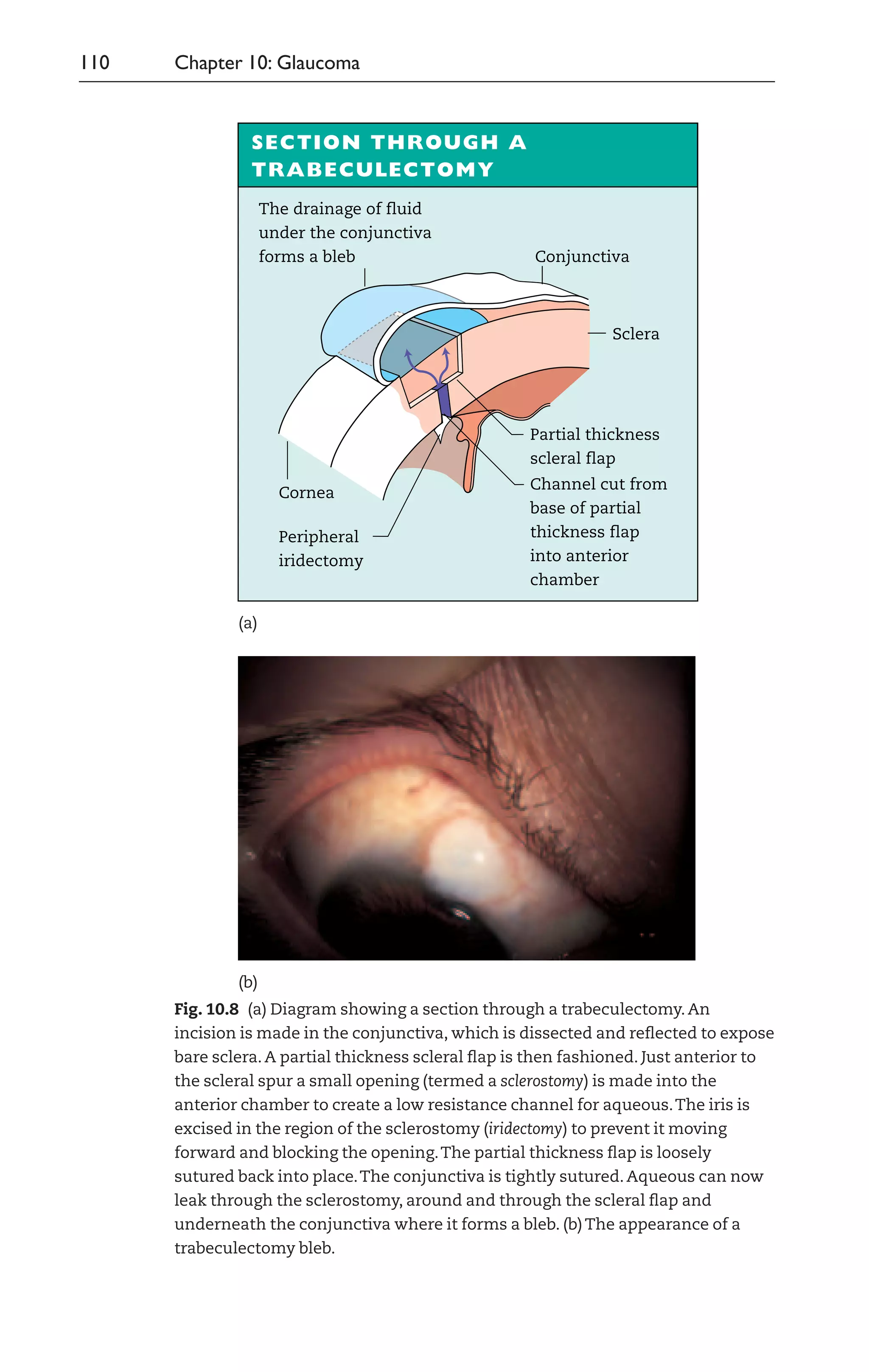 Lecture Notes on Ophthalmology.pdf