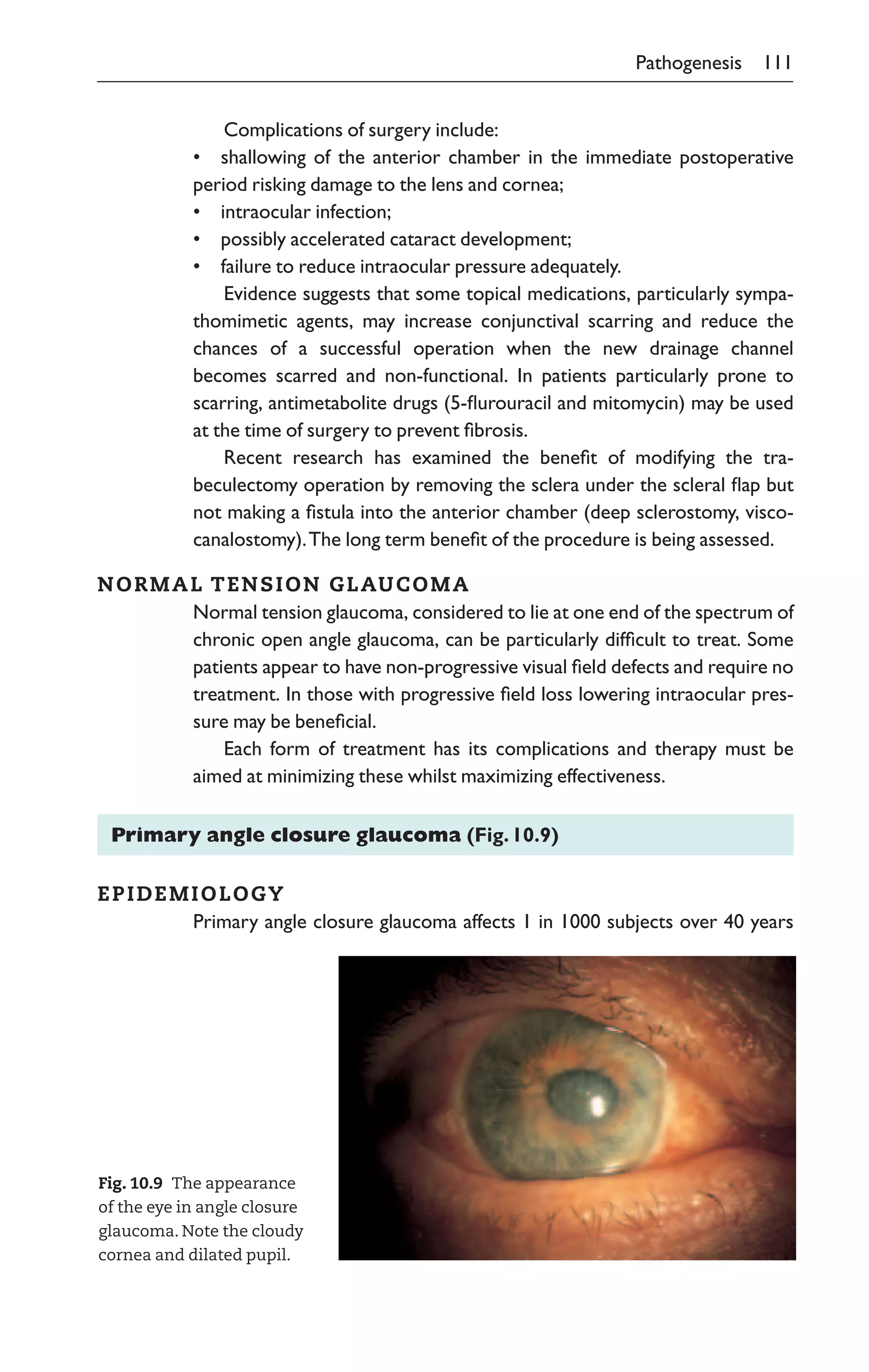 Lecture Notes on Ophthalmology.pdf