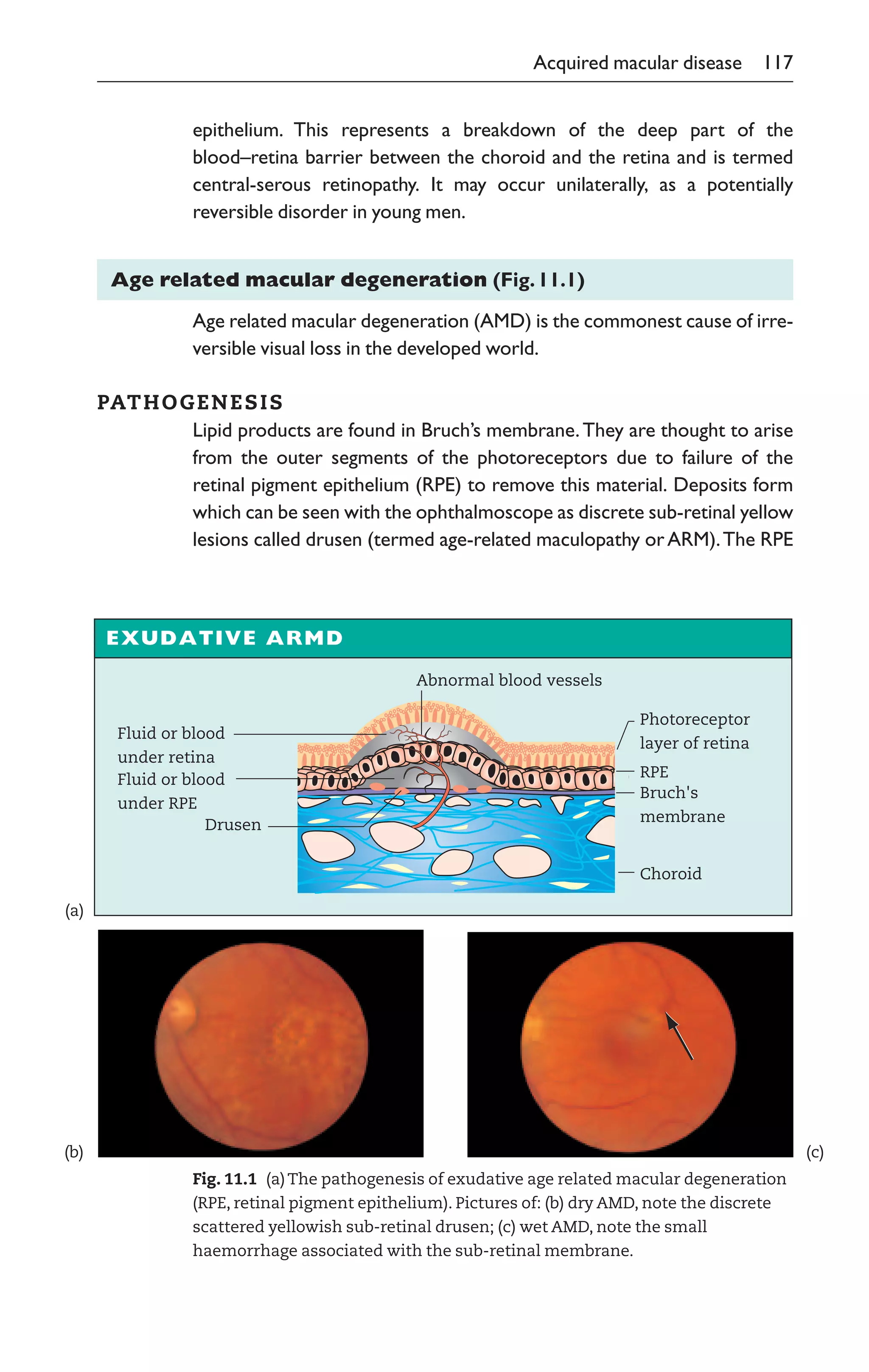 Lecture Notes on Ophthalmology.pdf