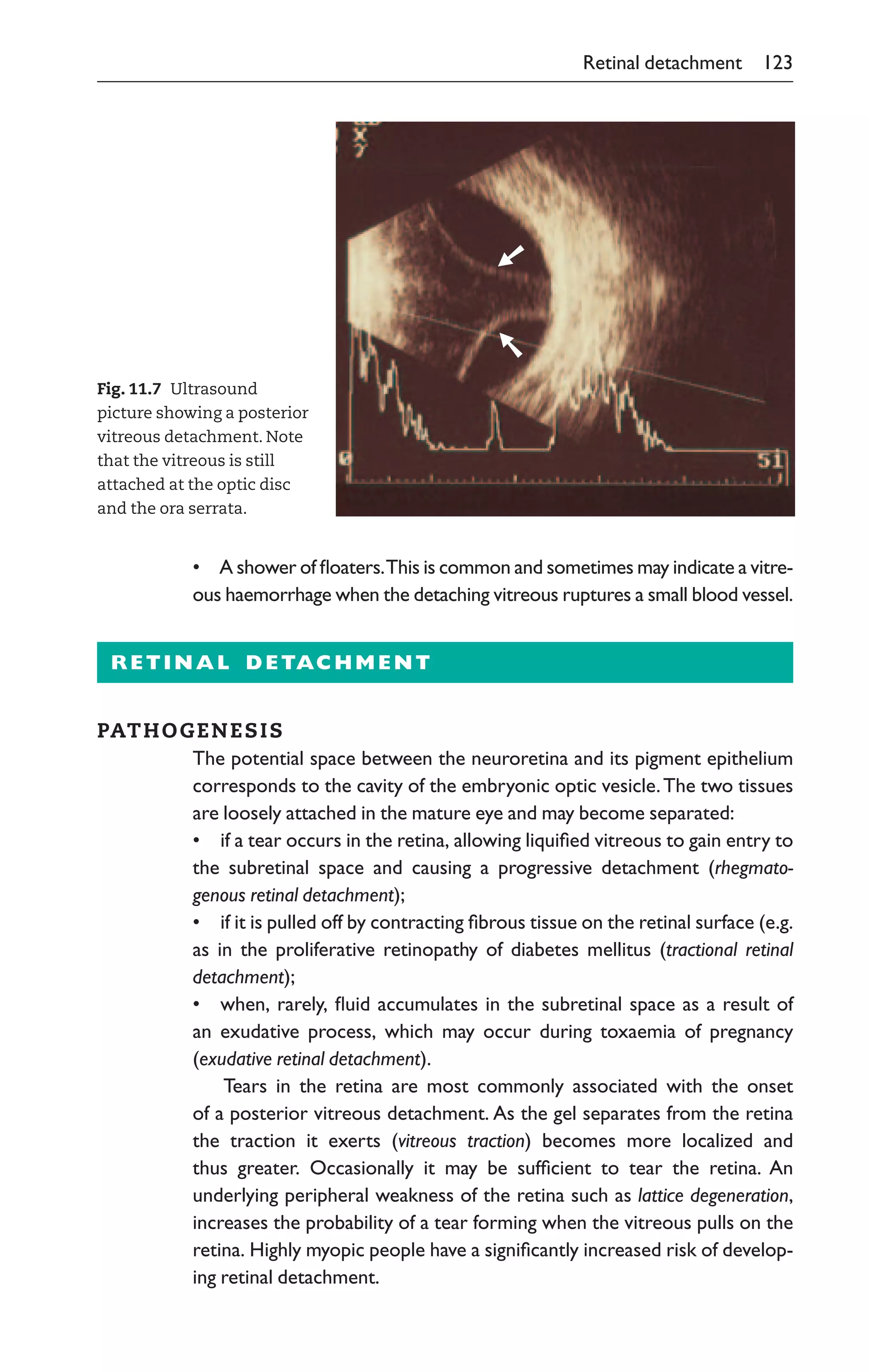 Lecture Notes on Ophthalmology.pdf