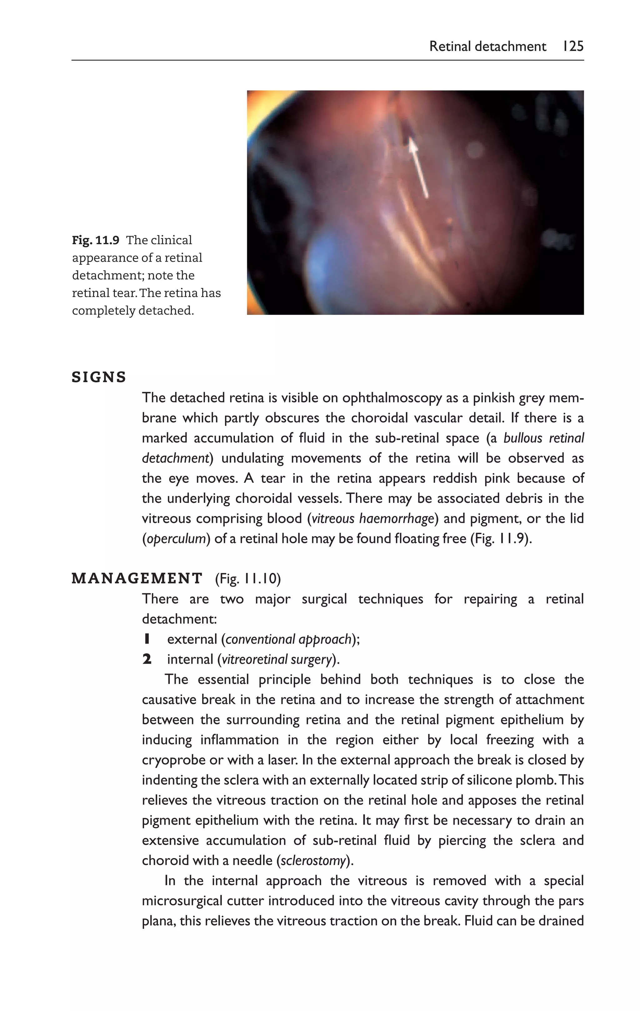 Lecture Notes on Ophthalmology.pdf