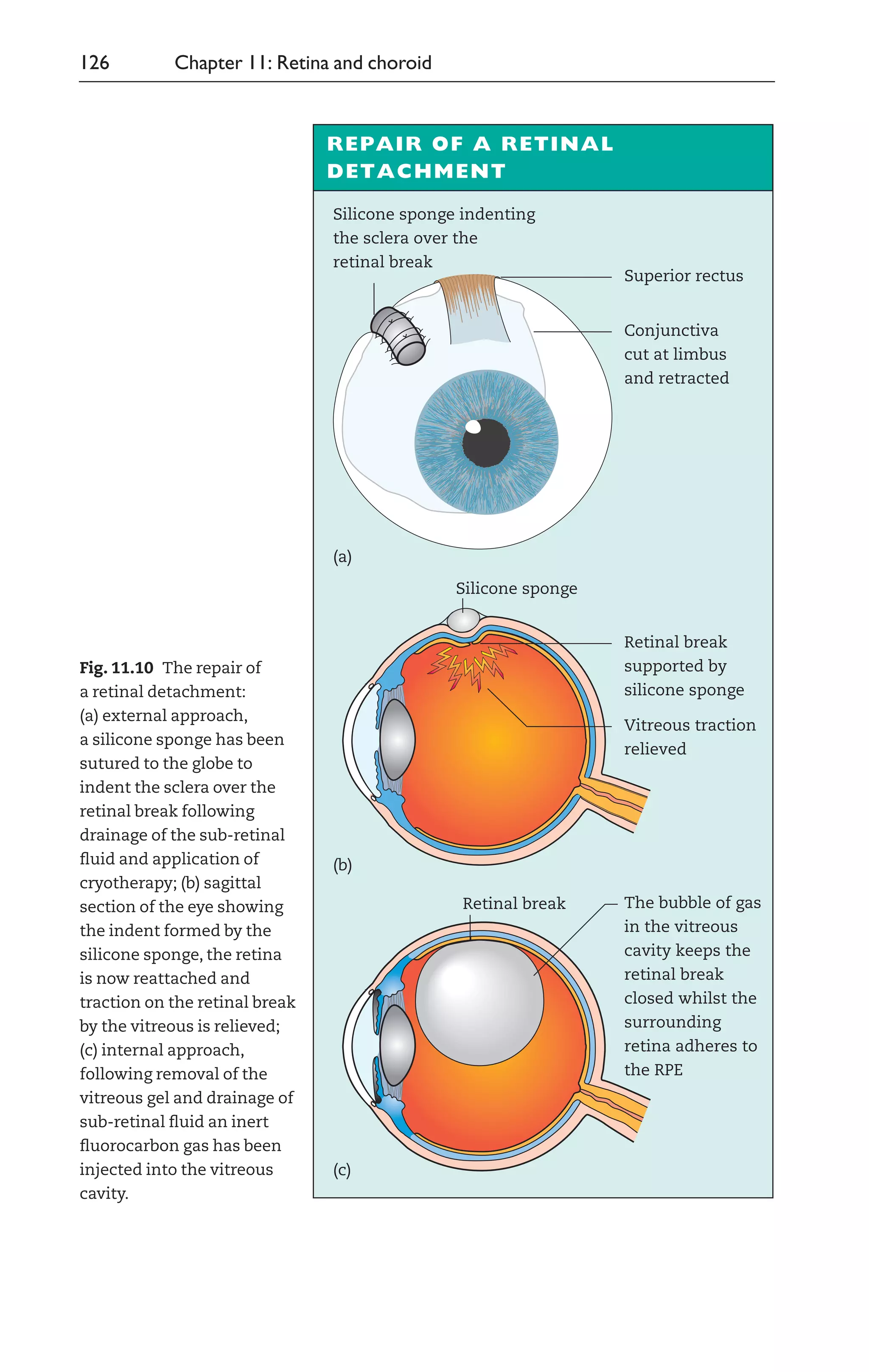 Lecture Notes on Ophthalmology.pdf