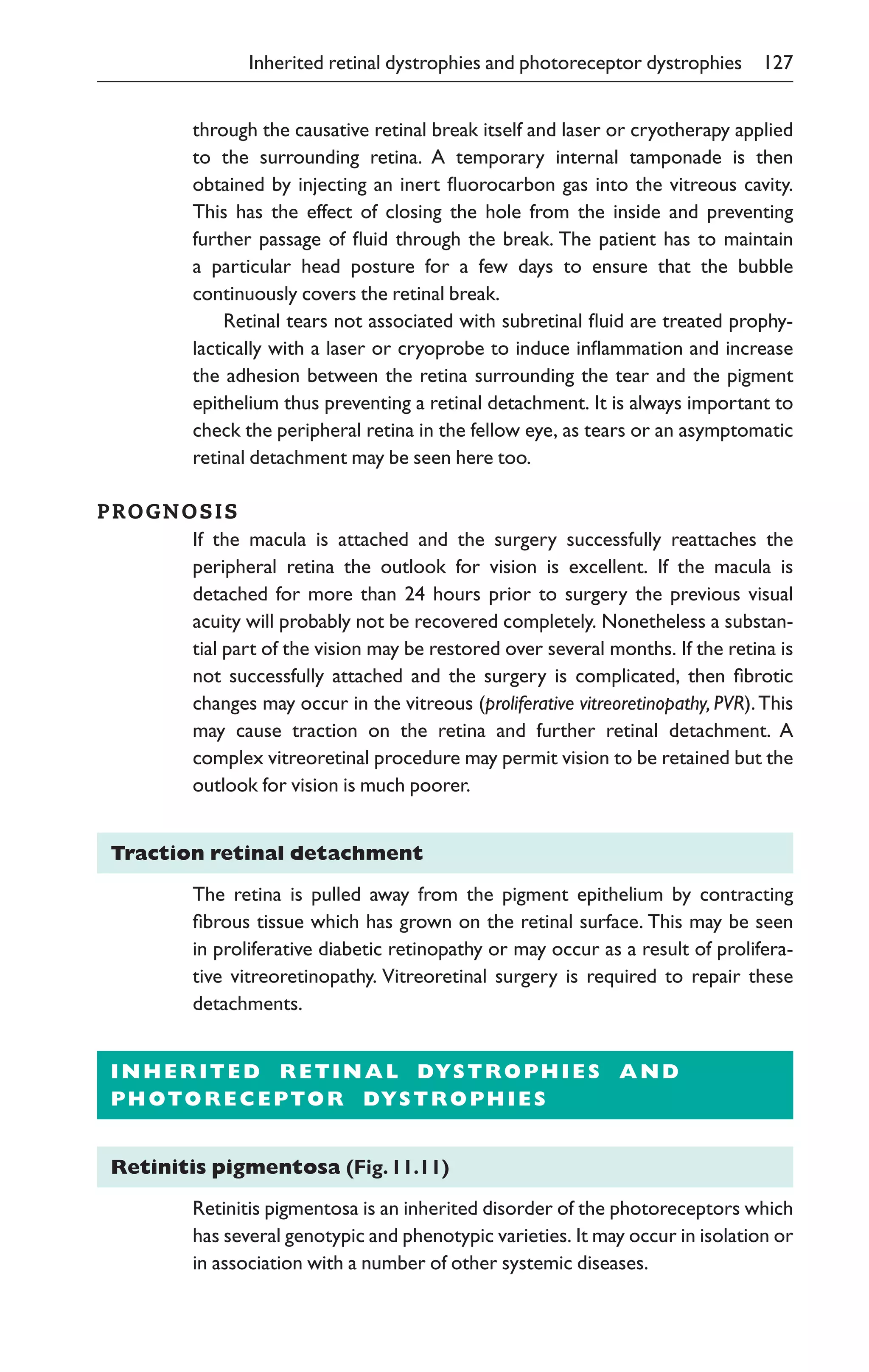 Lecture Notes on Ophthalmology.pdf
