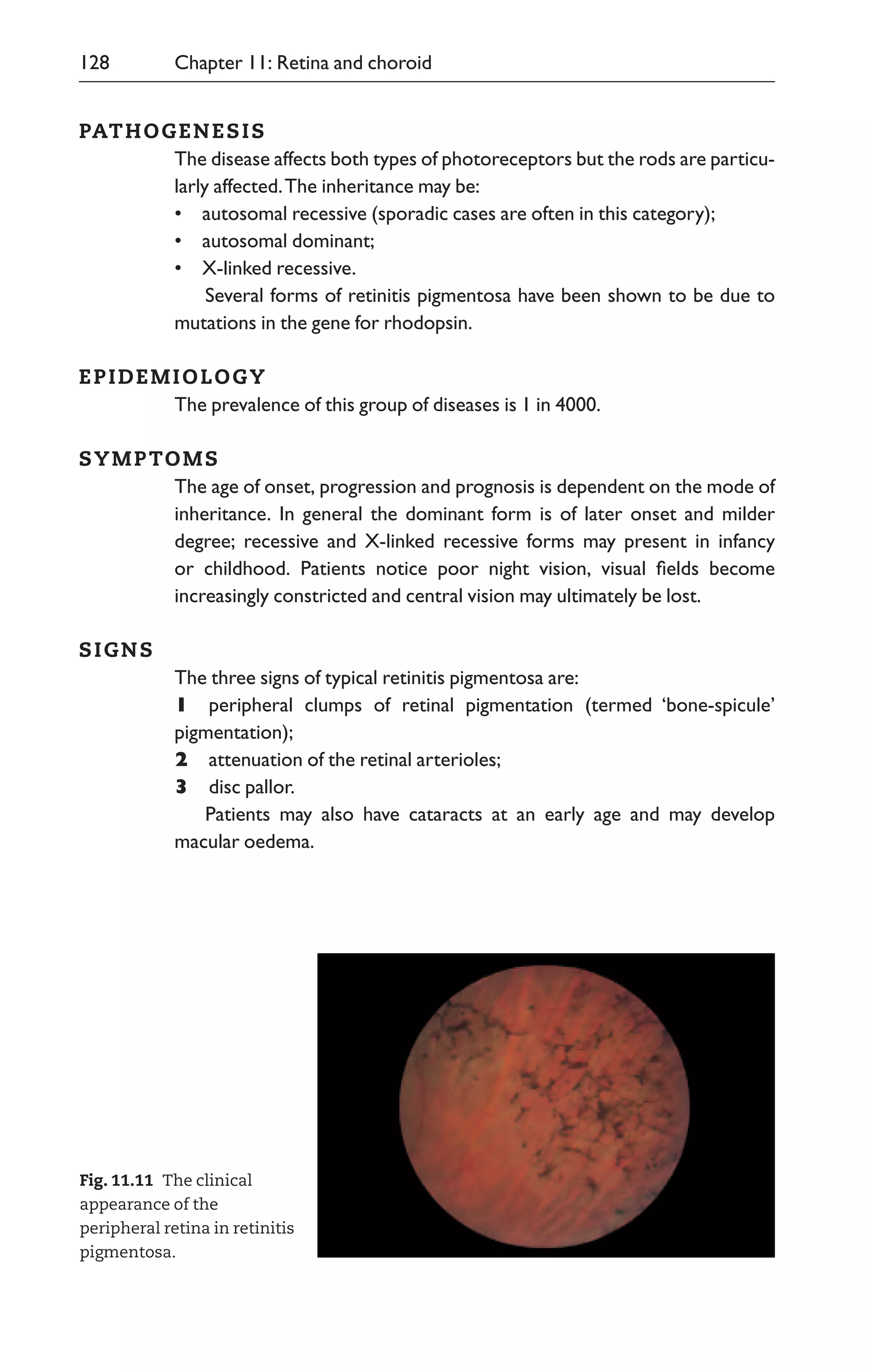Lecture Notes on Ophthalmology.pdf