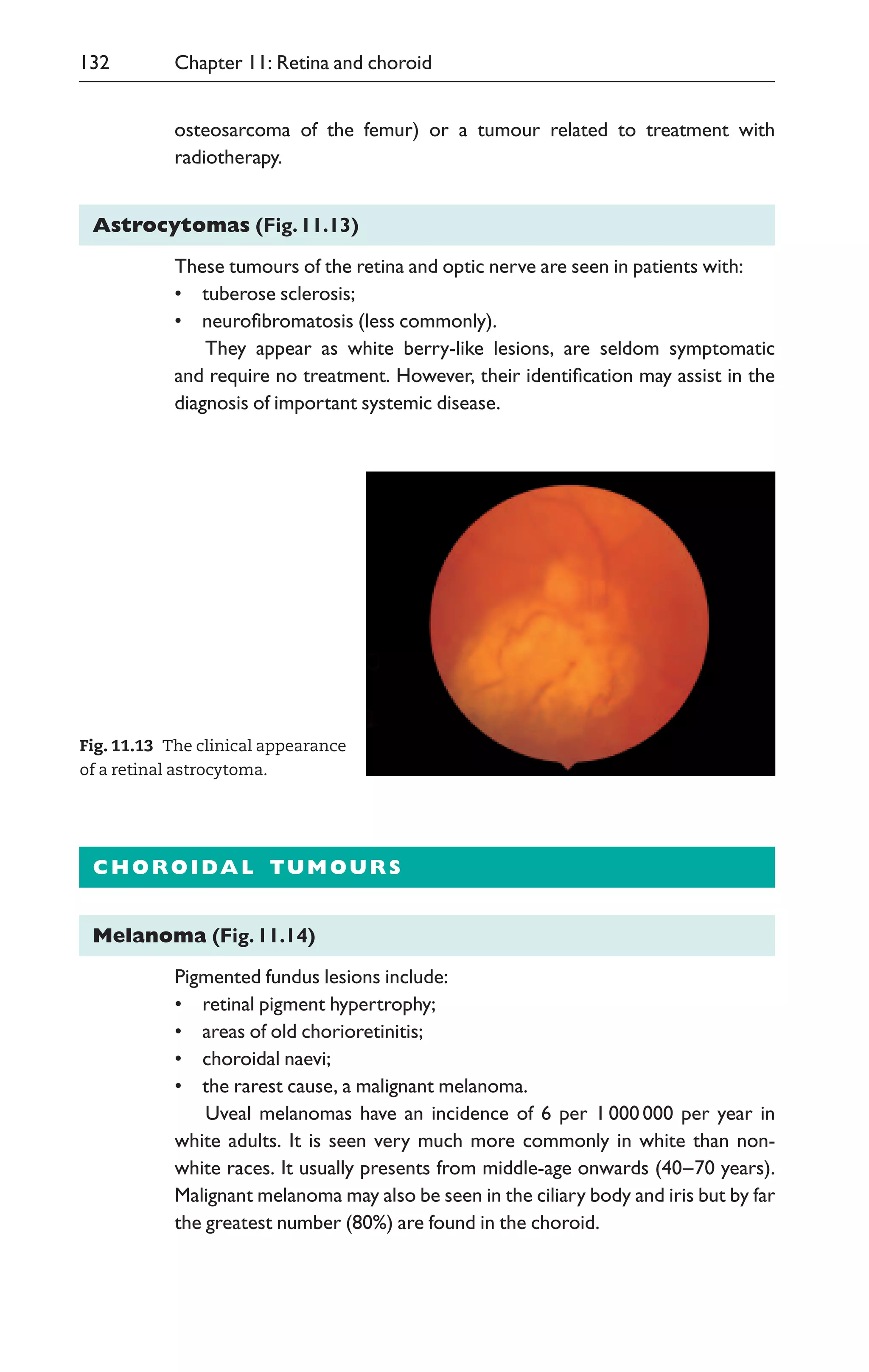 Lecture Notes on Ophthalmology.pdf
