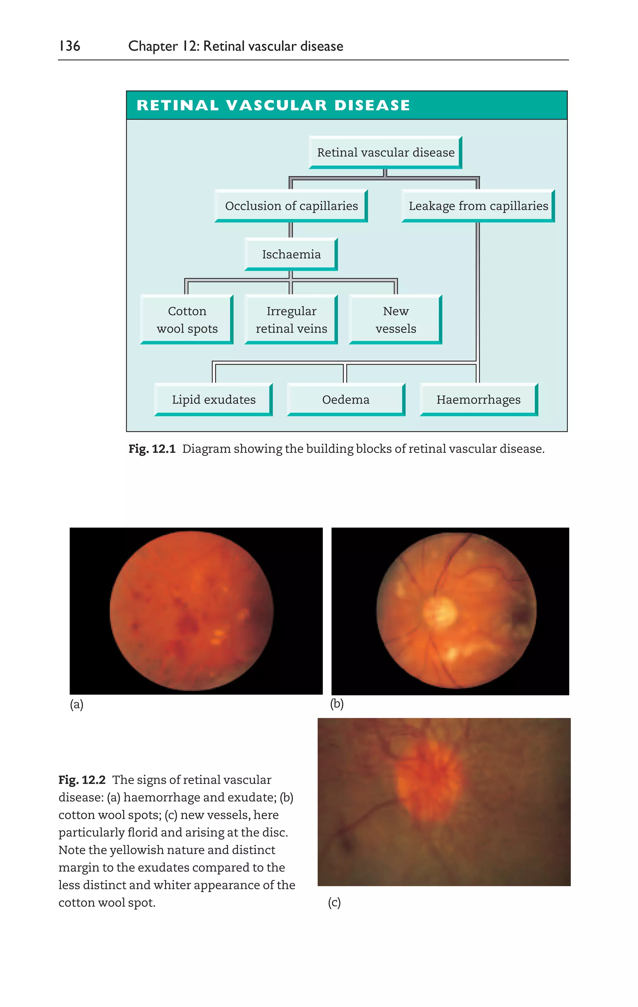Lecture Notes on Ophthalmology.pdf