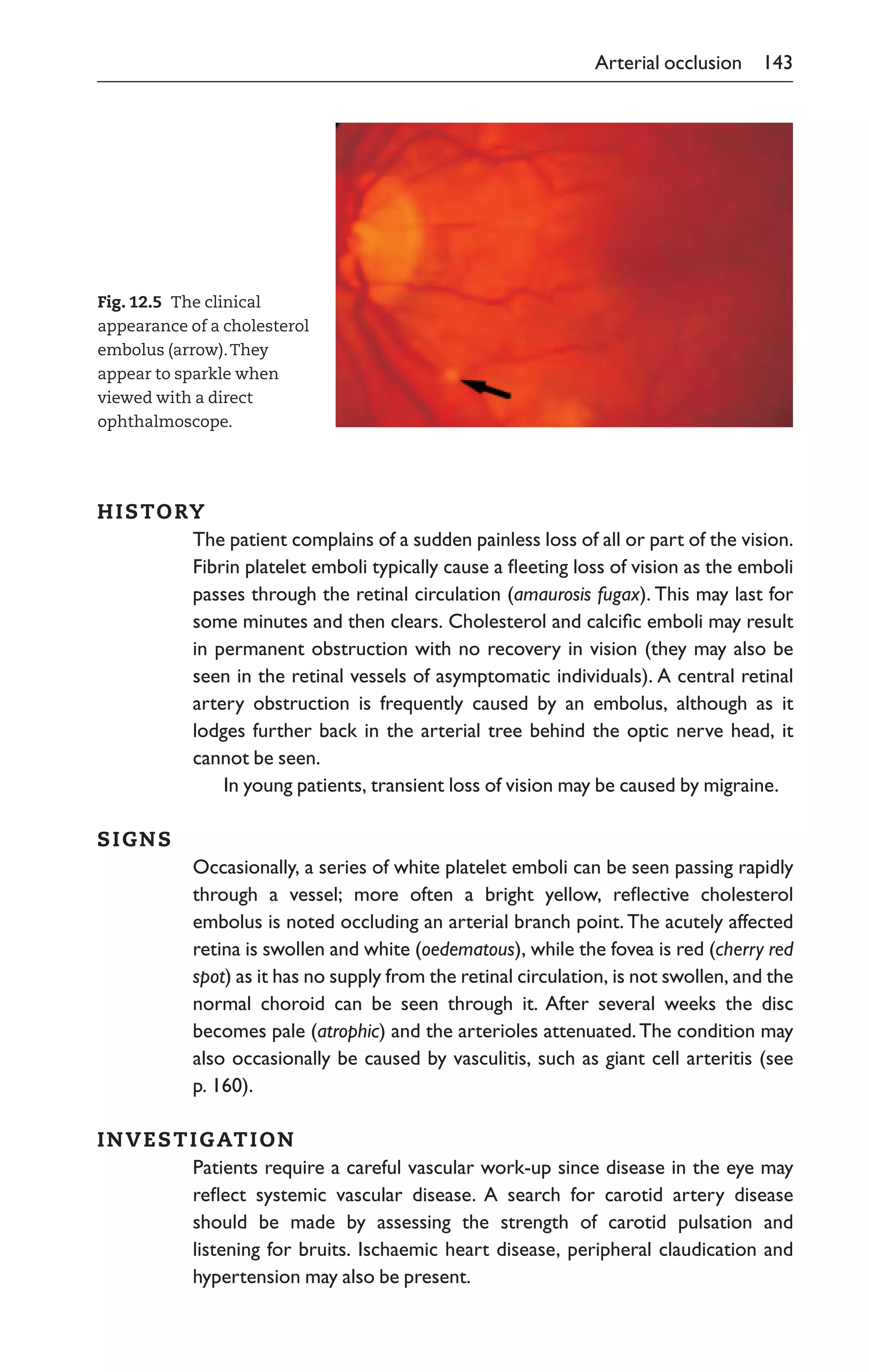 Lecture Notes on Ophthalmology.pdf