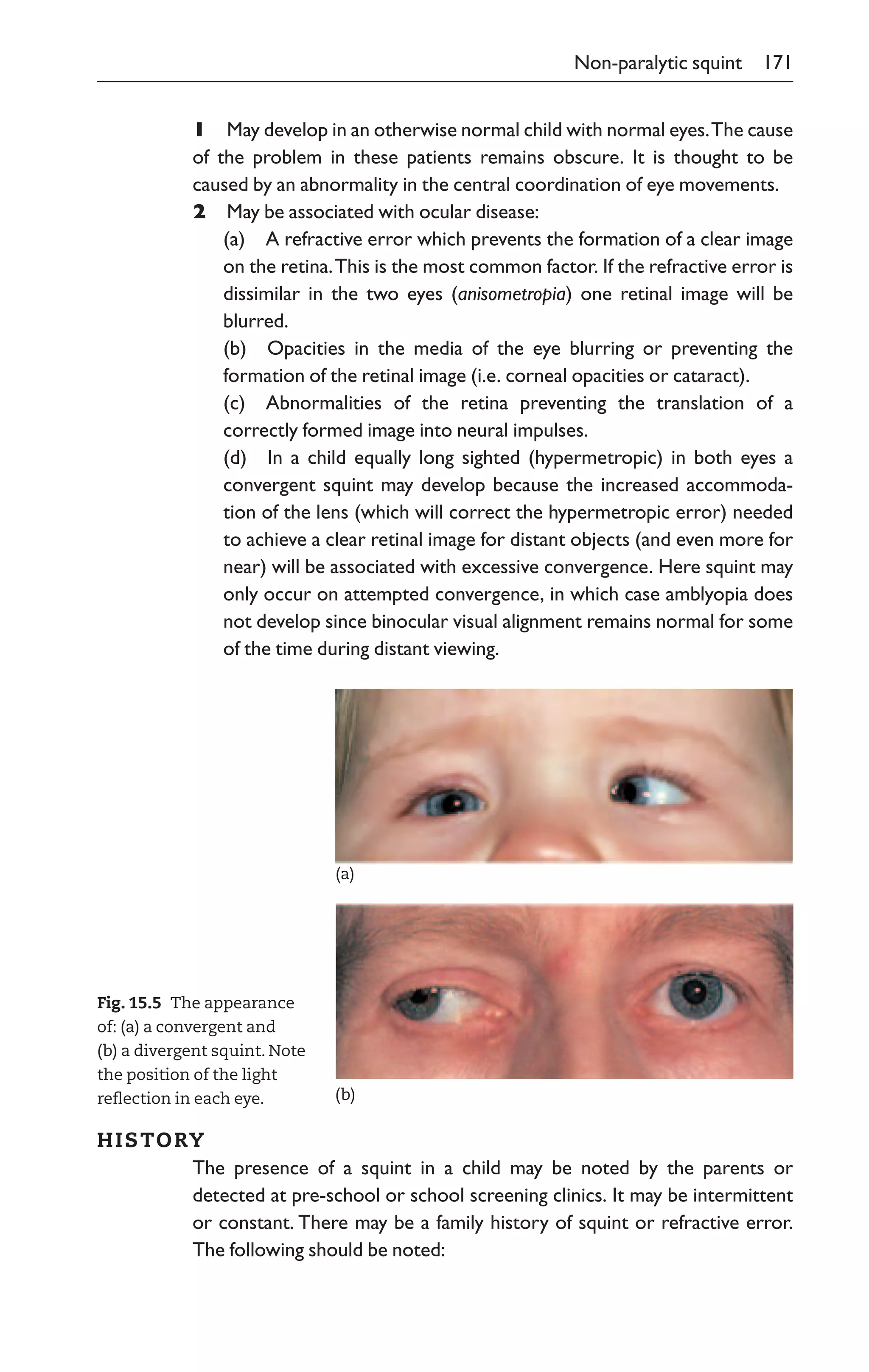 Lecture Notes on Ophthalmology.pdf