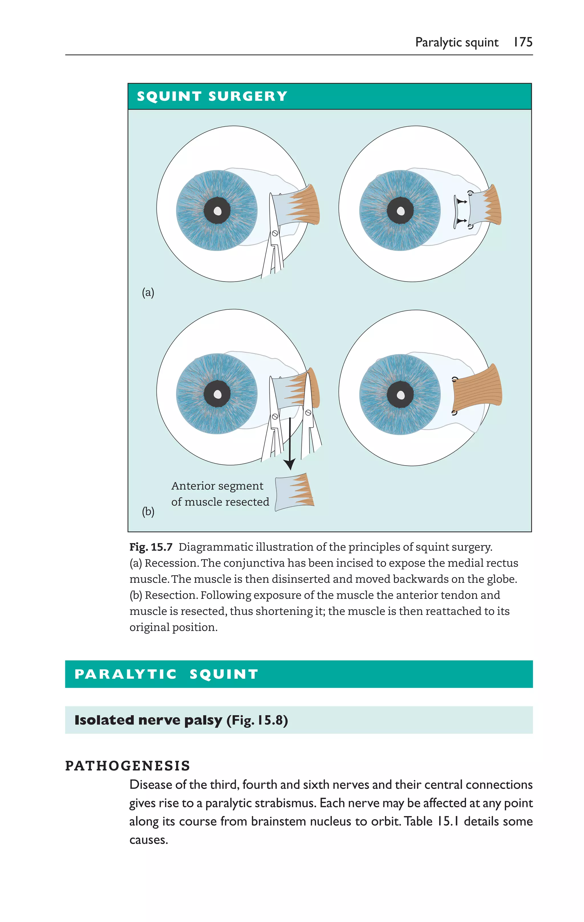 Lecture Notes on Ophthalmology.pdf