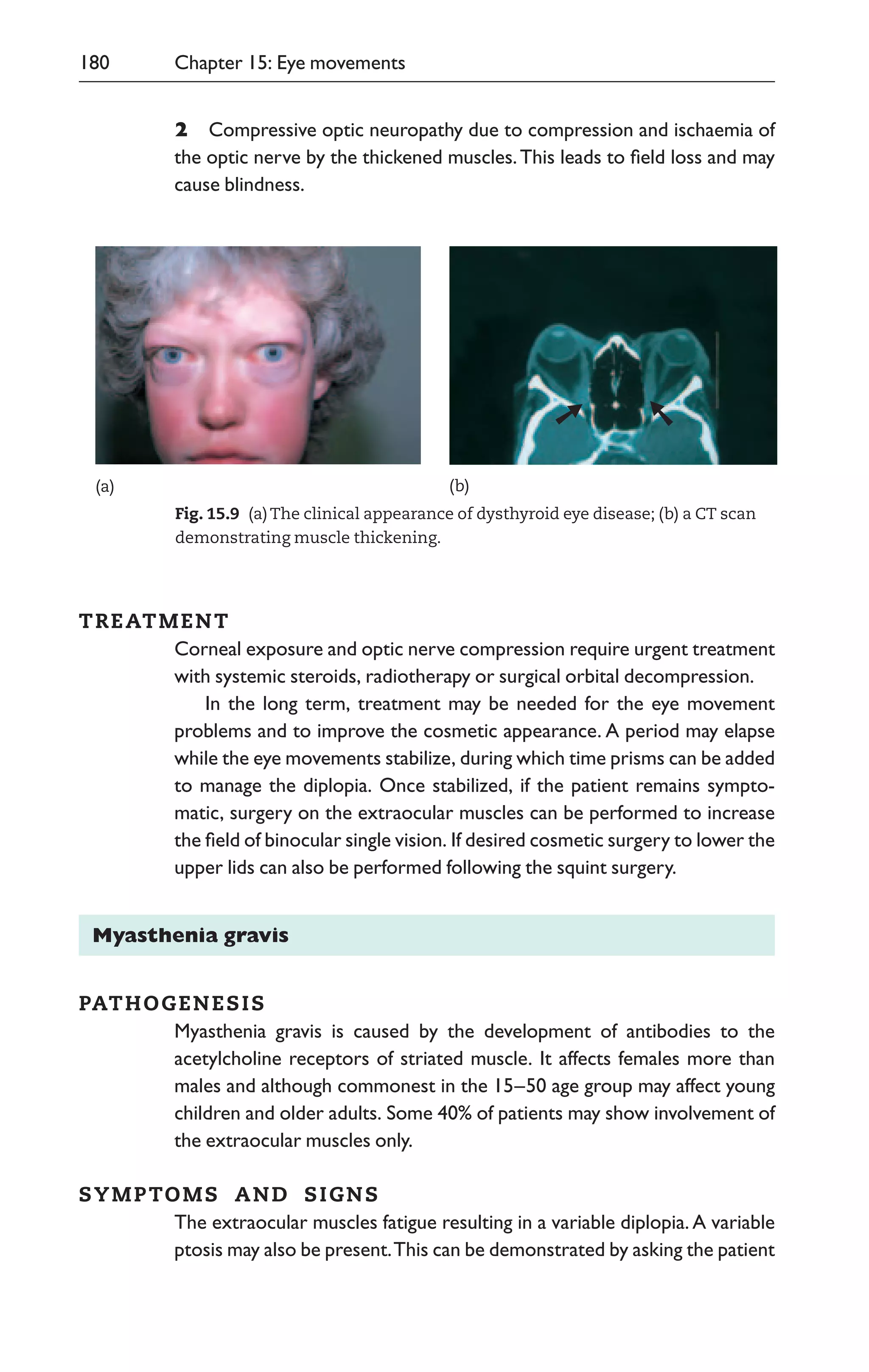 Lecture Notes on Ophthalmology.pdf