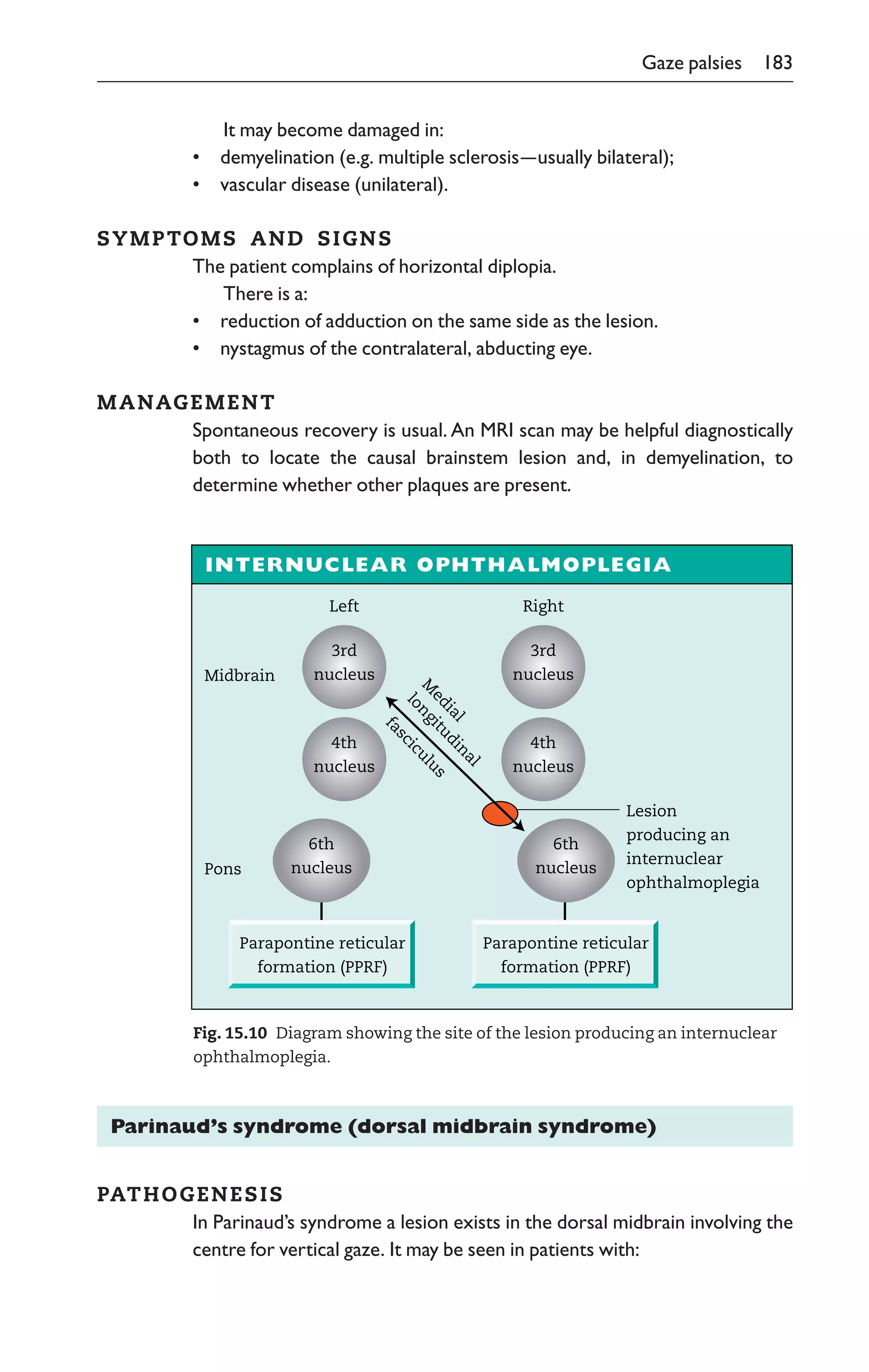 Lecture Notes on Ophthalmology.pdf