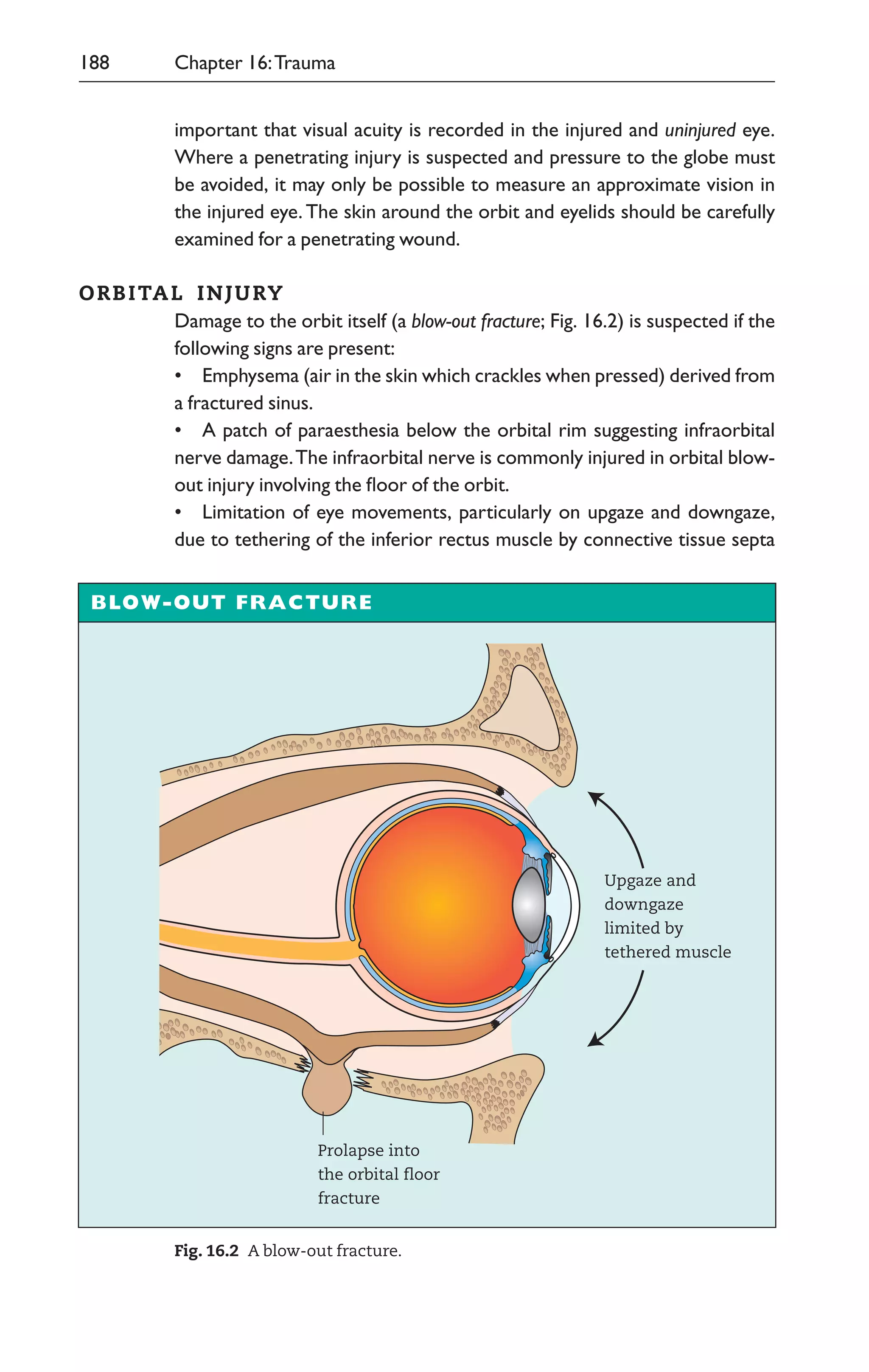 Lecture Notes on Ophthalmology.pdf
