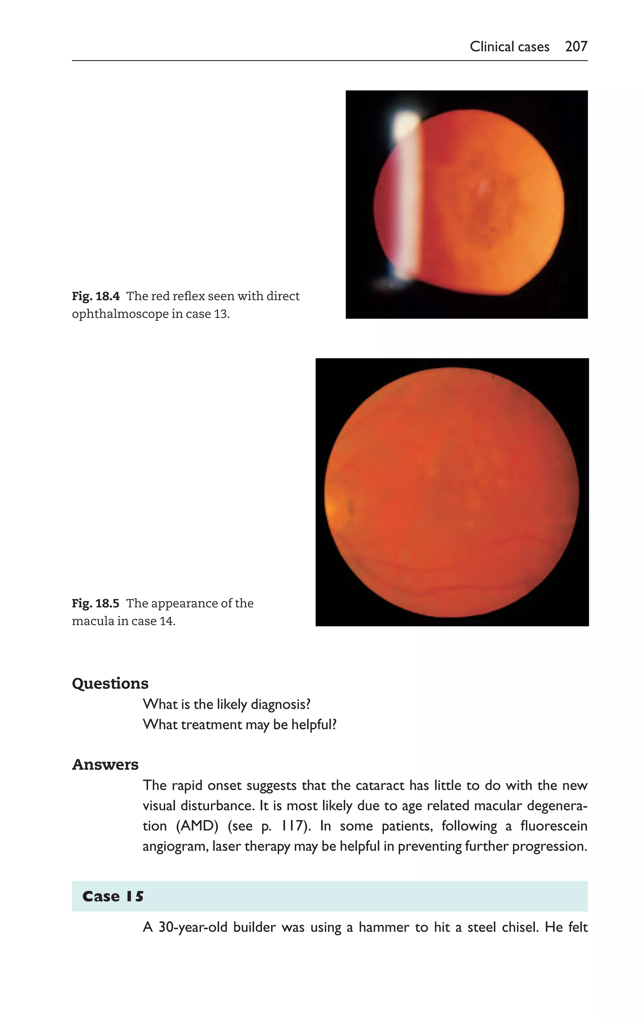 Lecture Notes on Ophthalmology.pdf