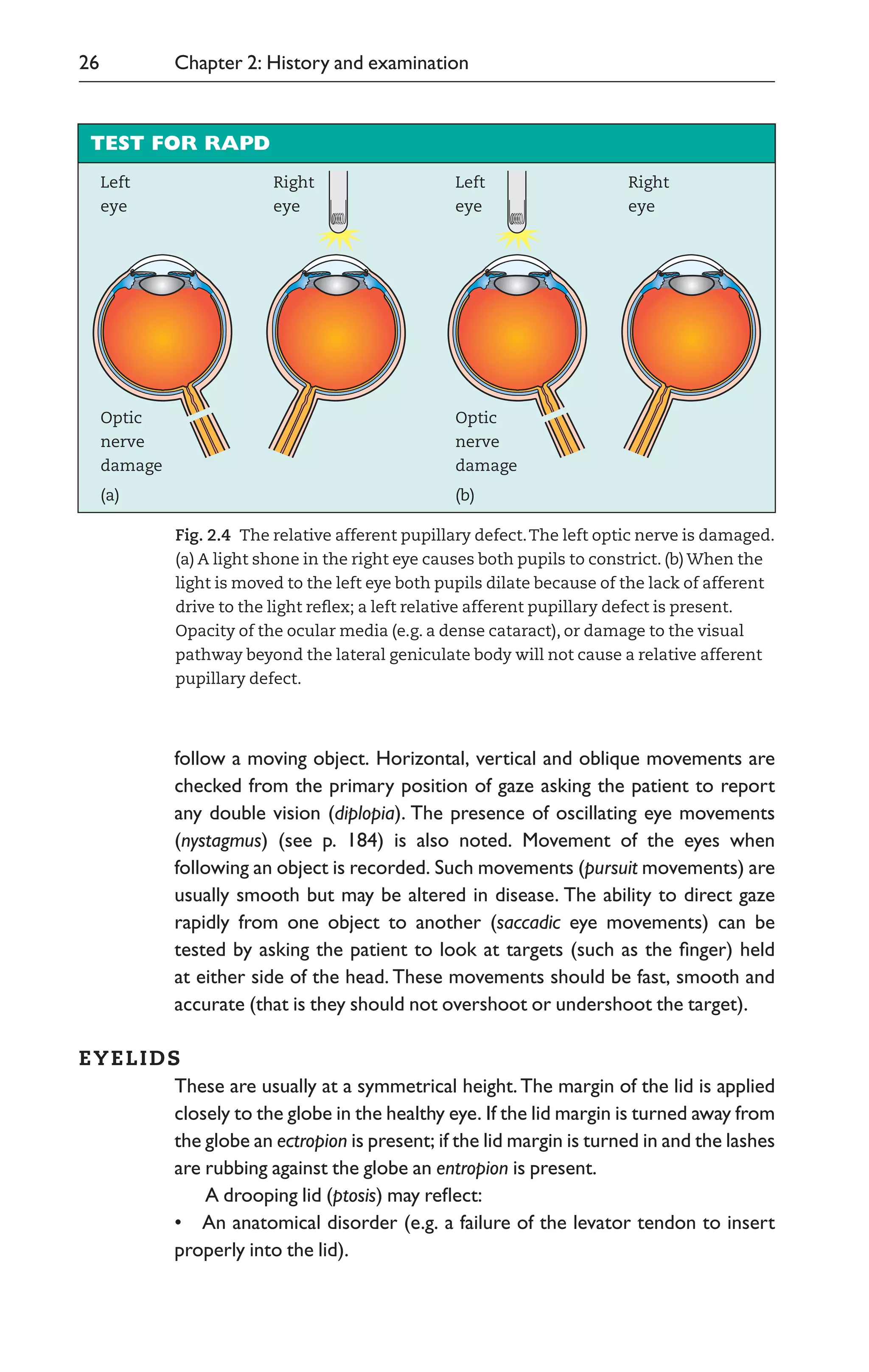 Lecture Notes on Ophthalmology.pdf