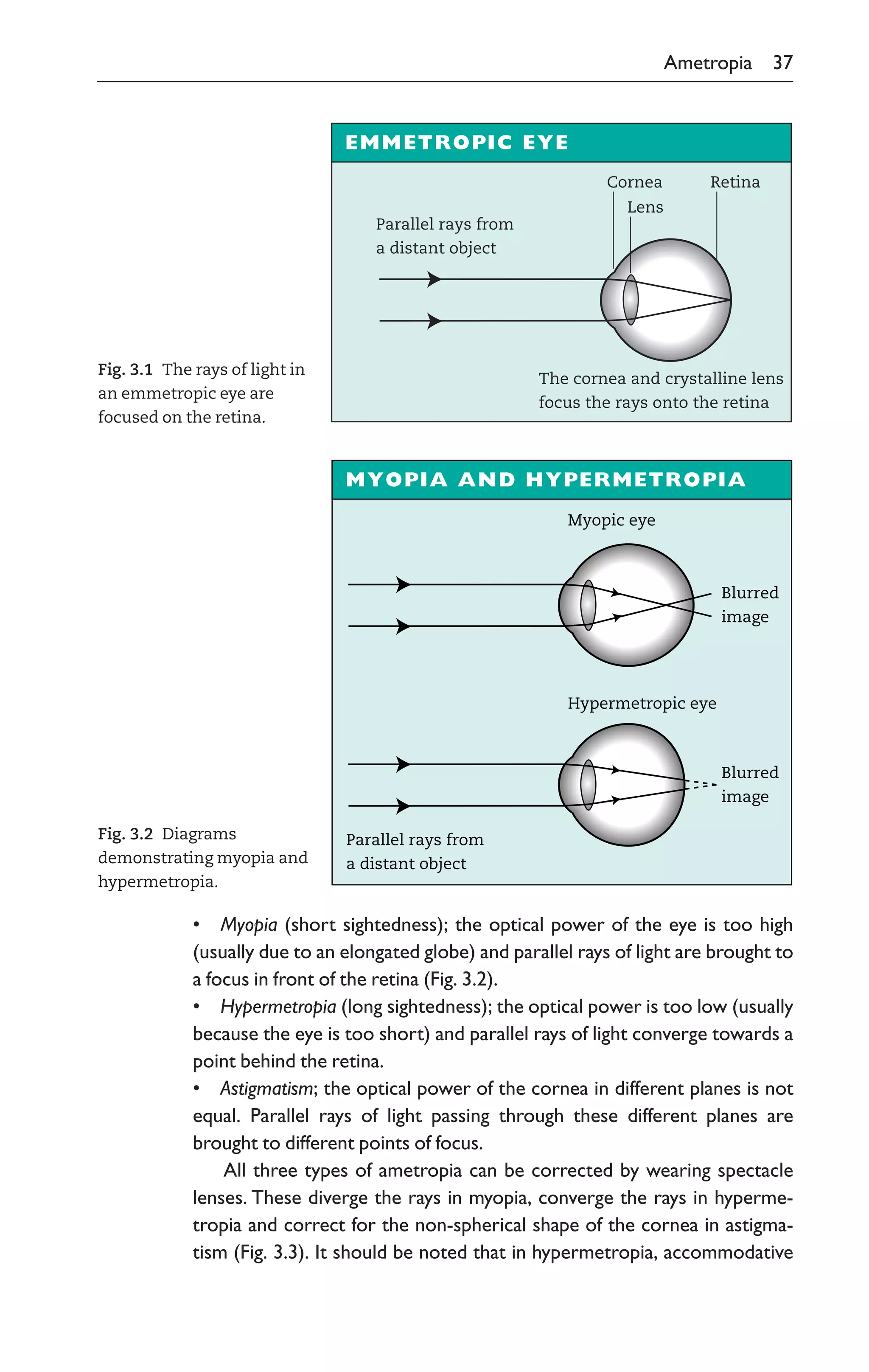 Lecture Notes on Ophthalmology.pdf