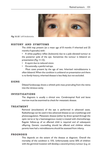 Lecture Notes on Ophthalmology.pdf