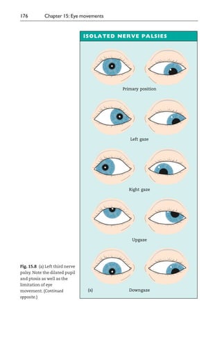 Lecture Notes on Ophthalmology.pdf
