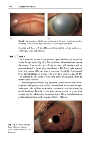 Lecture Notes on Ophthalmology.pdf