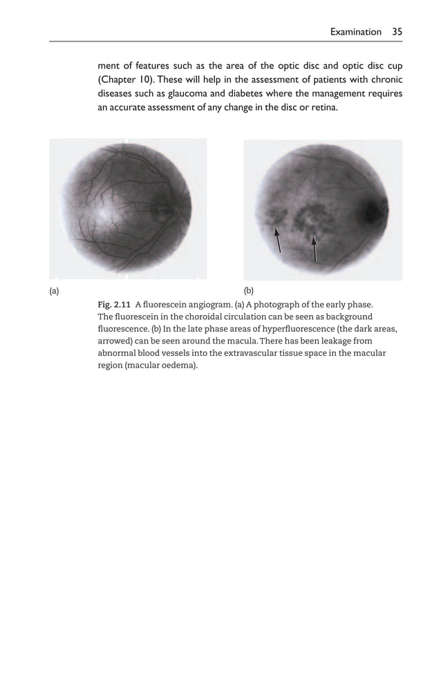 Lecture Notes on Ophthalmology.pdf