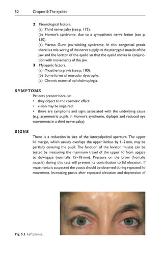 Lecture Notes on Ophthalmology.pdf