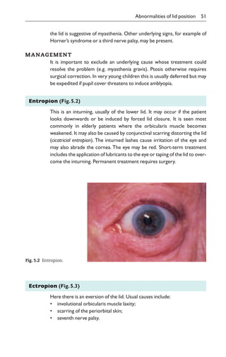 Lecture Notes on Ophthalmology.pdf