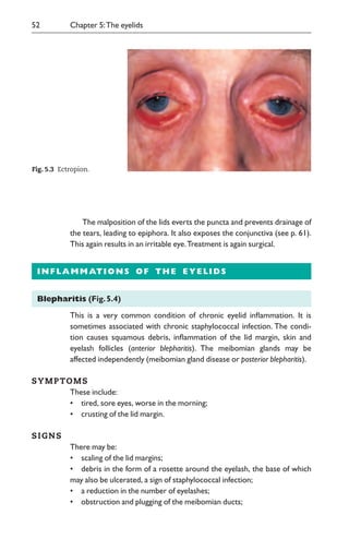 Lecture Notes on Ophthalmology.pdf