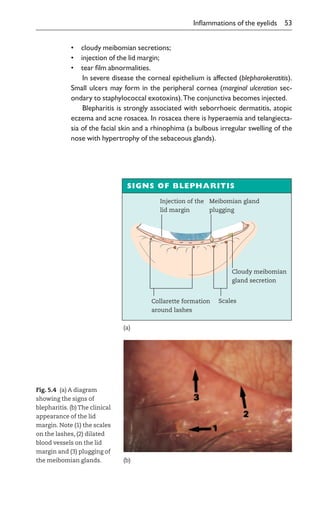 Lecture Notes on Ophthalmology.pdf