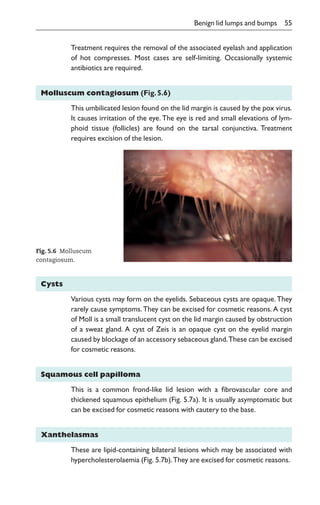 Lecture Notes on Ophthalmology.pdf