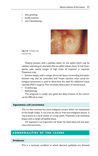 Lecture Notes on Ophthalmology.pdf