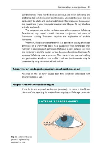Lecture Notes on Ophthalmology.pdf