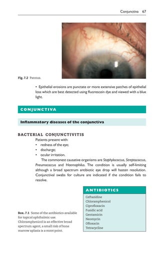Lecture Notes on Ophthalmology.pdf