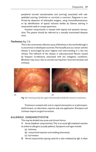 Lecture Notes on Ophthalmology.pdf