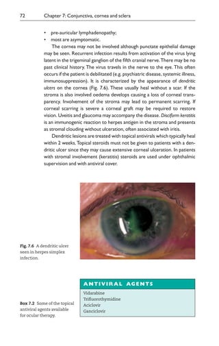 Lecture Notes on Ophthalmology.pdf