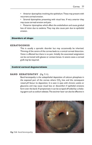 Lecture Notes on Ophthalmology.pdf